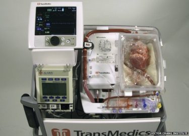 Australian doctors perform pioneering heart transplants